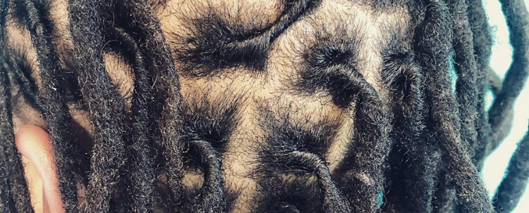 5 Essential Methods to Avoid Buildup in Your Locs – Dr Locs
