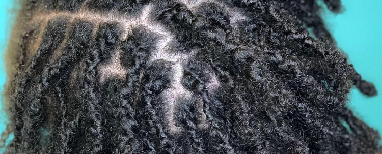 Is My Hair Too Thin To Loc? – Dr Locs